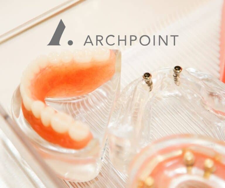 Snap-On Dentures | ARCHPOINT Implant Dentistry